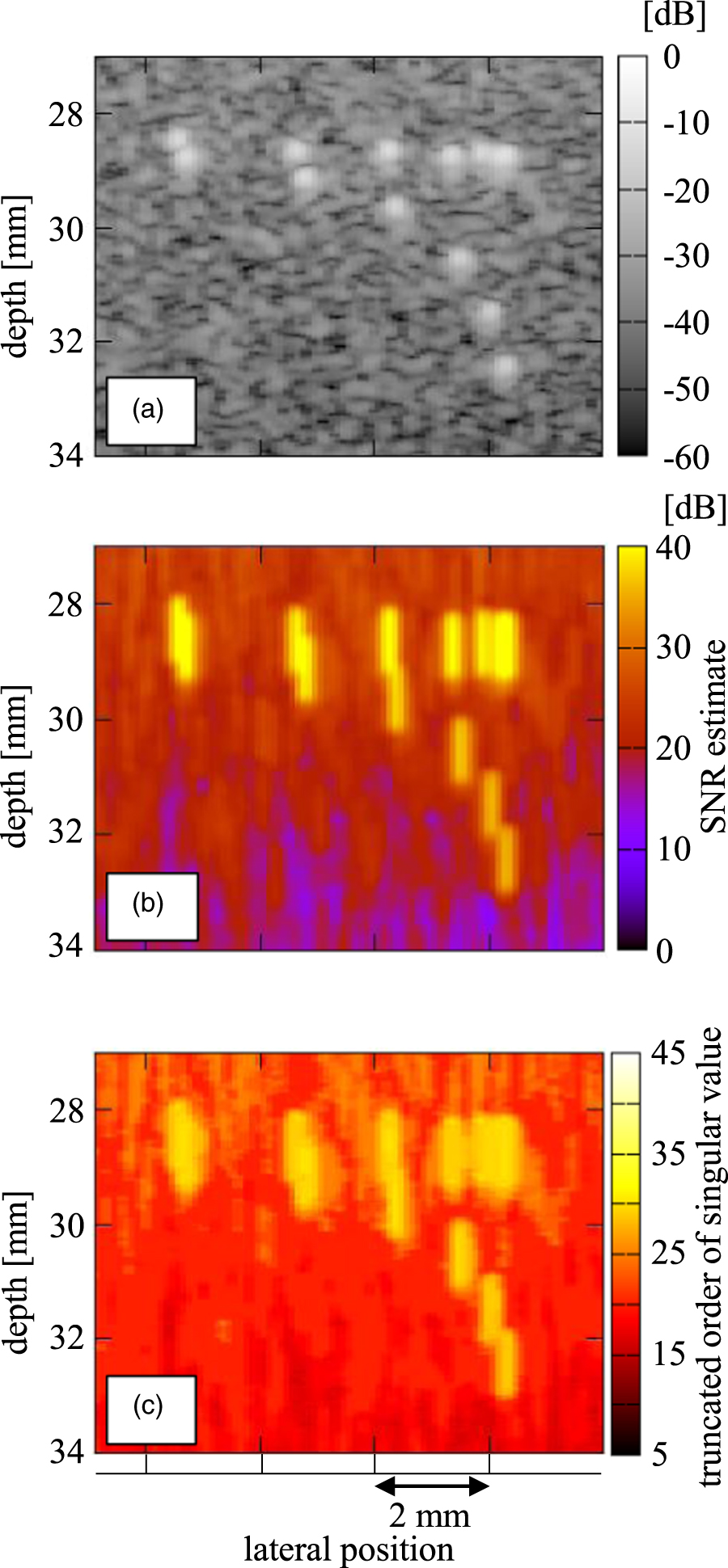 Improving axial resolution of medical ultrasound images by using noise ...