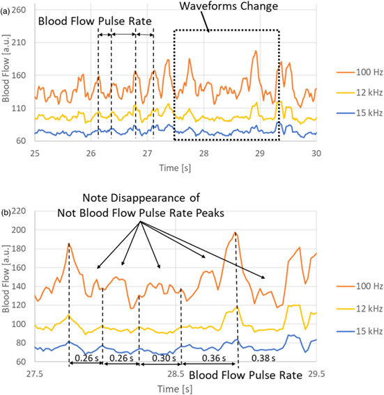 Non-wearable pulse rate measurement system using laser Doppler ...