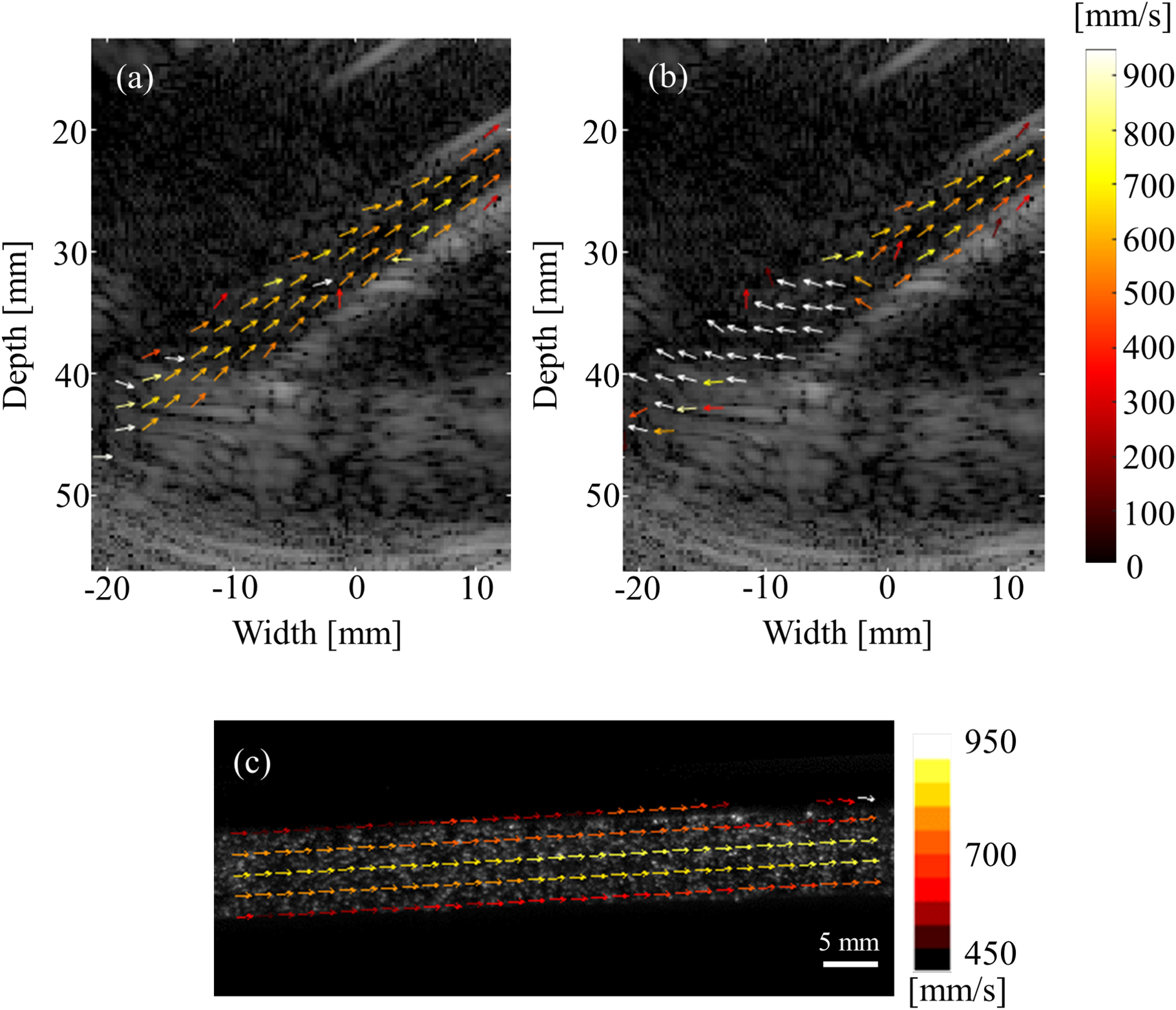 Robust flow vector estimation for echocardiography with extended ...