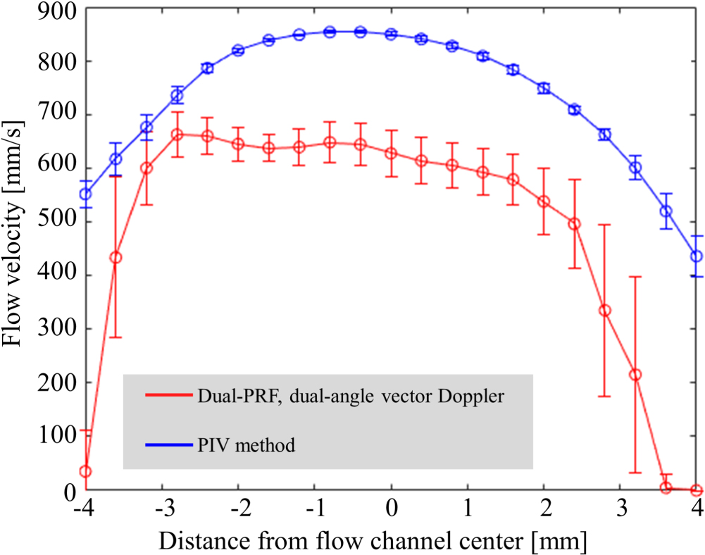 Robust flow vector estimation for echocardiography with extended ...