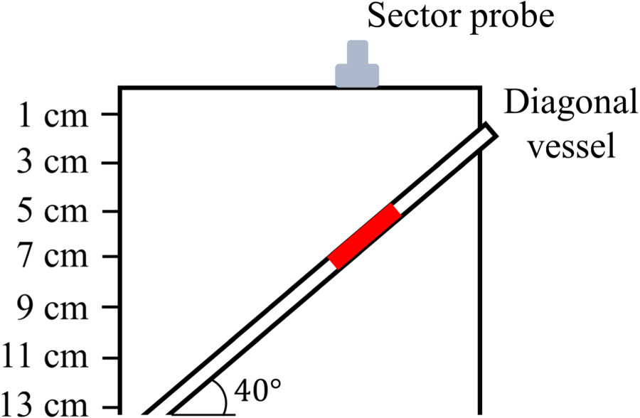 Robust flow vector estimation for echocardiography with extended ...