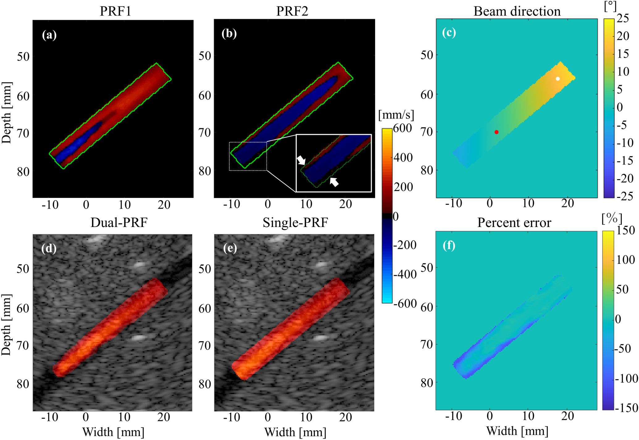 Robust flow vector estimation for echocardiography with extended ...