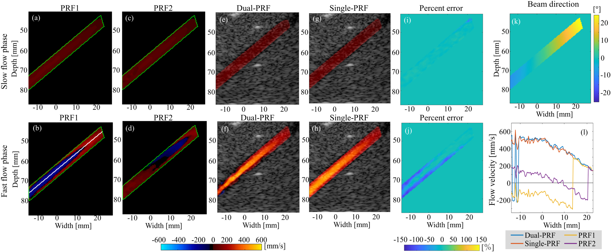 Robust flow vector estimation for echocardiography with extended ...