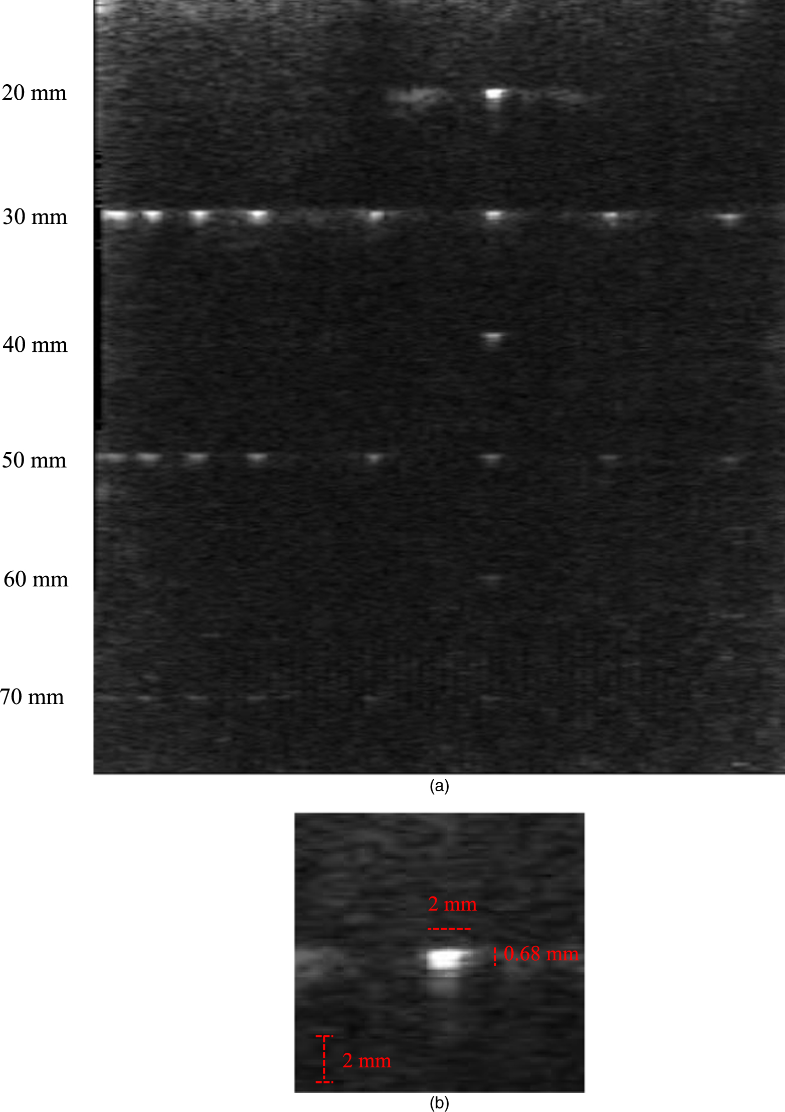 Thin, flexible, and biocompatible medical ultrasound array transducer ...