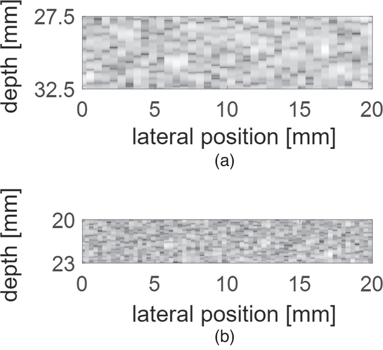 Quantification of limitations in statistical analysis of ultrasound ...