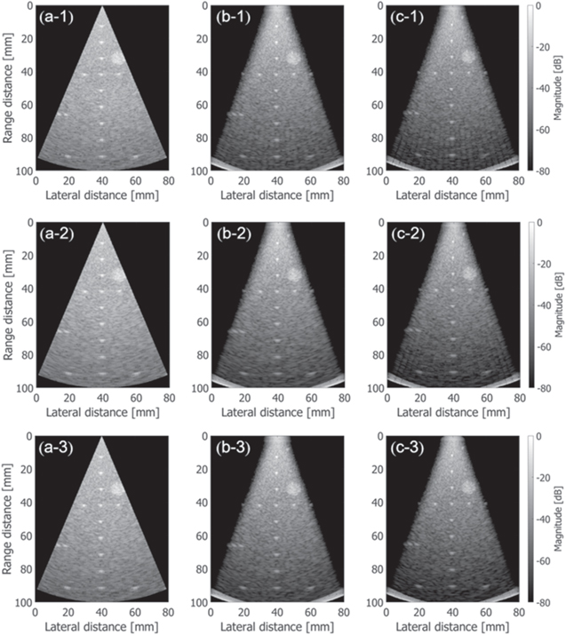 Investigation on synthetic aperture imaging using focused transmit ...