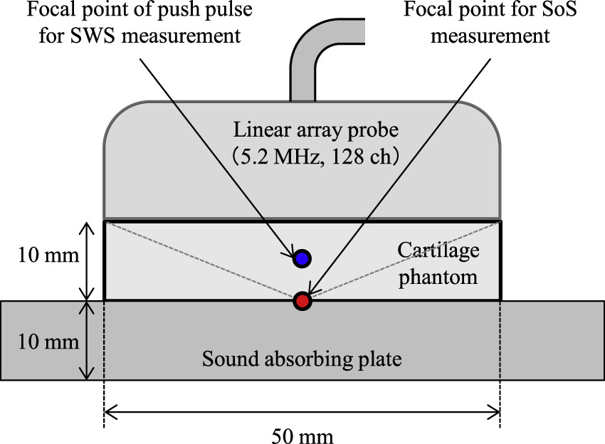 Preliminary study on cartilage tissue evaluation based on longitudinal ...