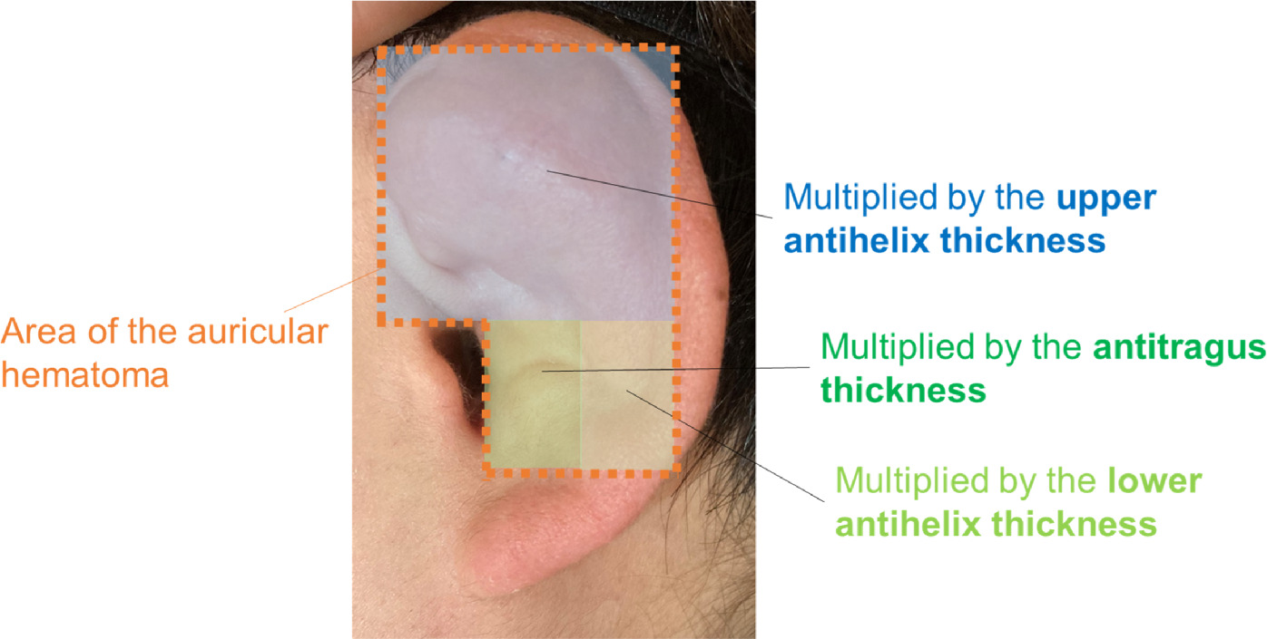 Effect of hematoma-induced changes in auricular hardness, thickness and ...