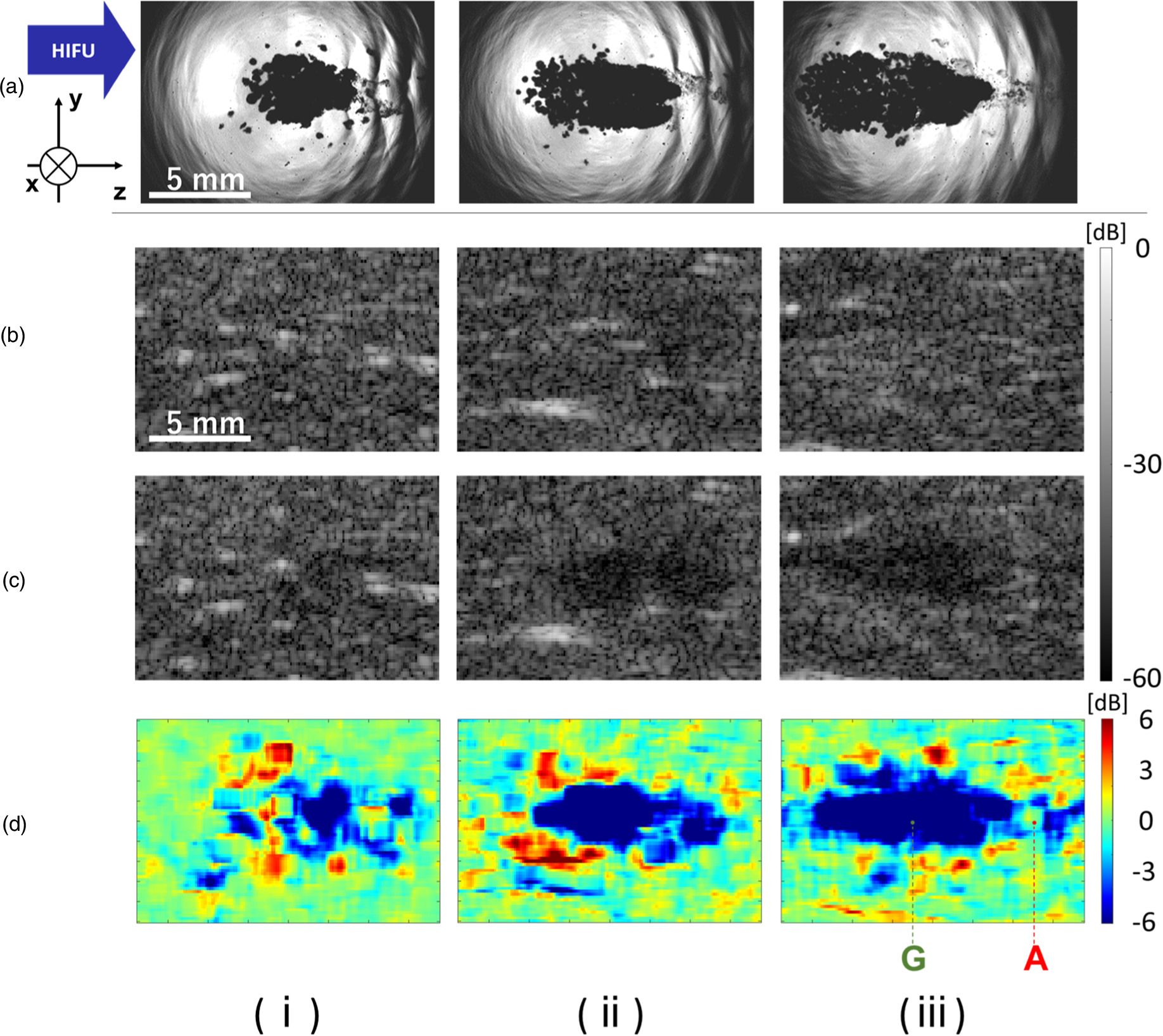 Effect of pulse repetition frequency on efficiency of tissue erosion in ...