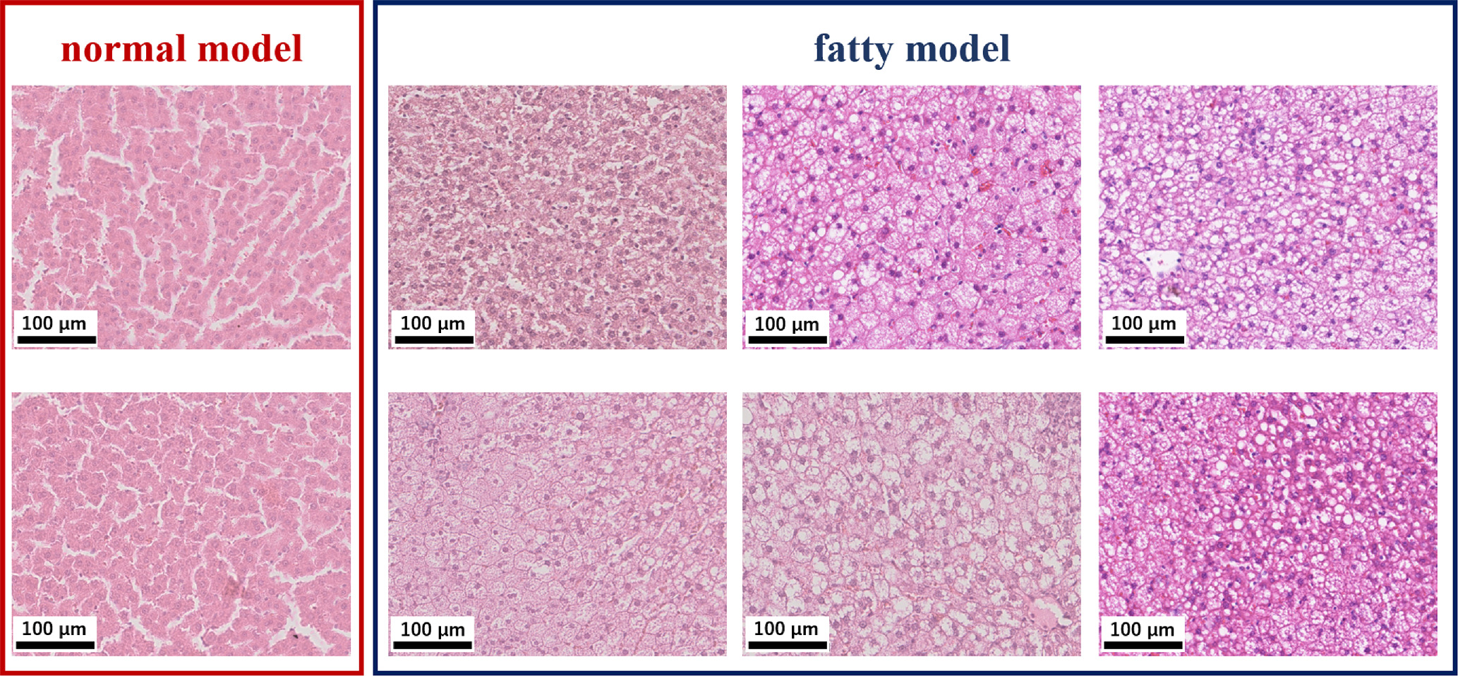 Basic study on the effects of fat deposition in rat liver on the ...