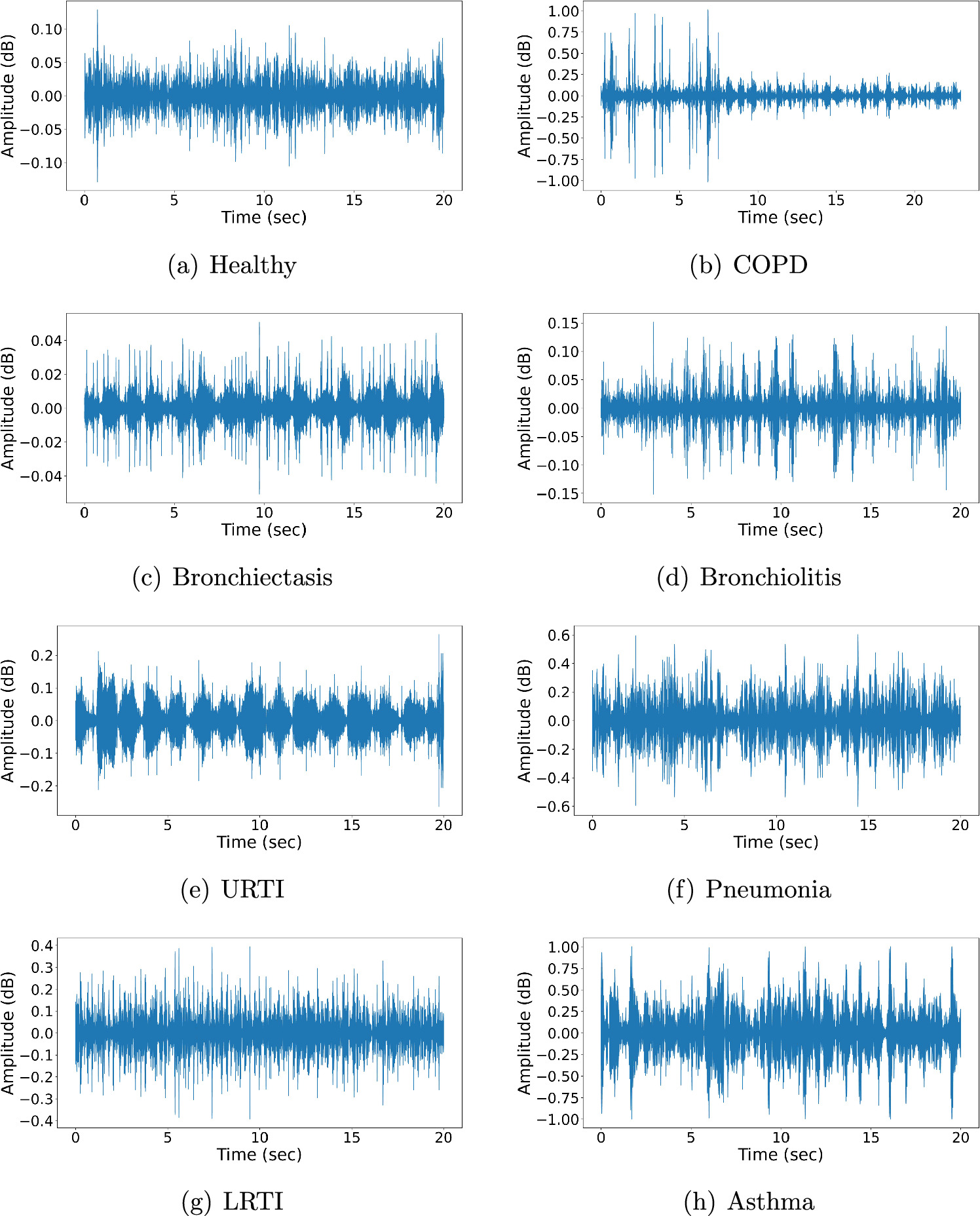 Respiratory sound classification utilizing human auditory-based feature extraction - IOPscience