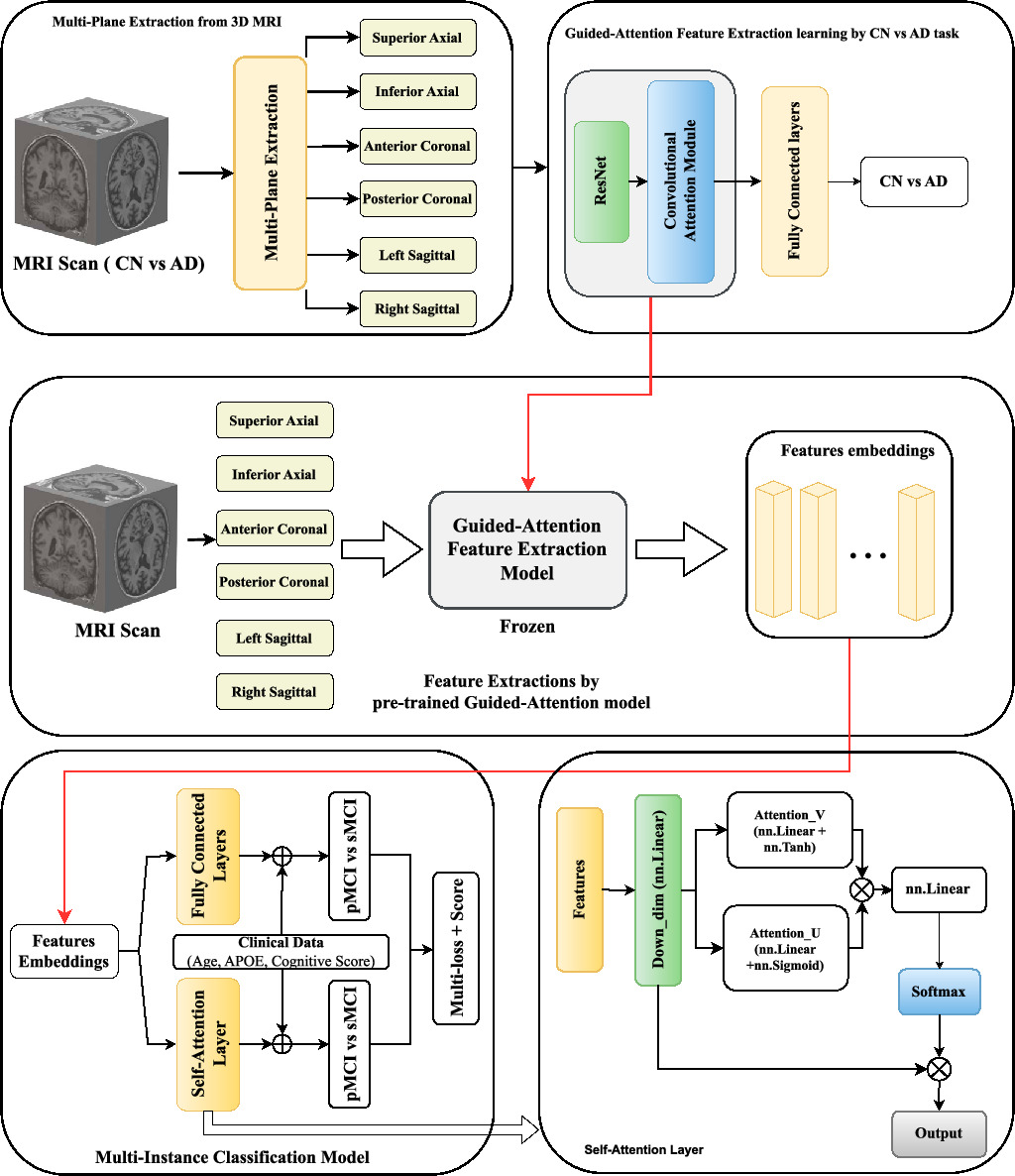 Deep learning with guided attention for early diagnosis of Alzheimer’s ...