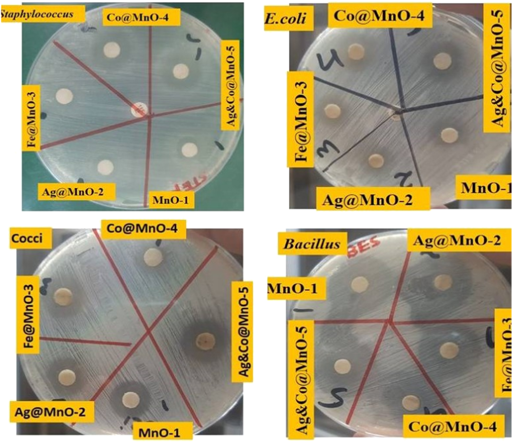 Excellent photocatalytic and antibacterial performance of silver and ...