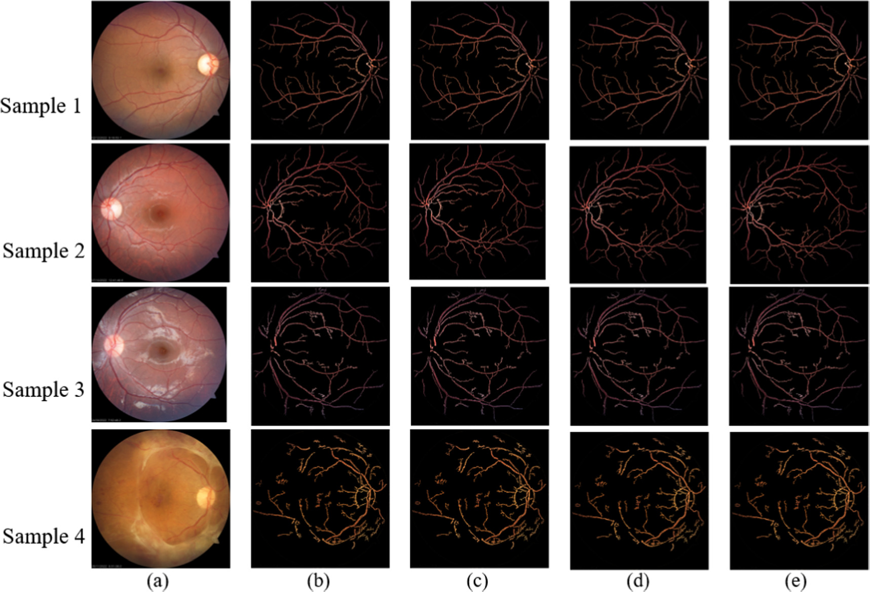A new highly fractal 1D- chaotic map-based novel encryption on HVS ...