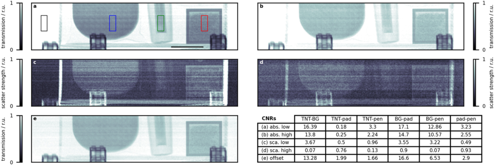 Increased material differentiation through multi-contrast x-ray imaging ...