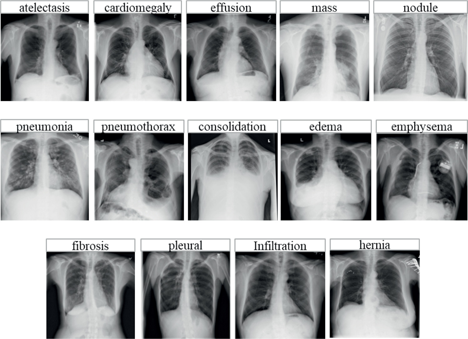 Artificial intelligence and feature based transfer learning framework ...