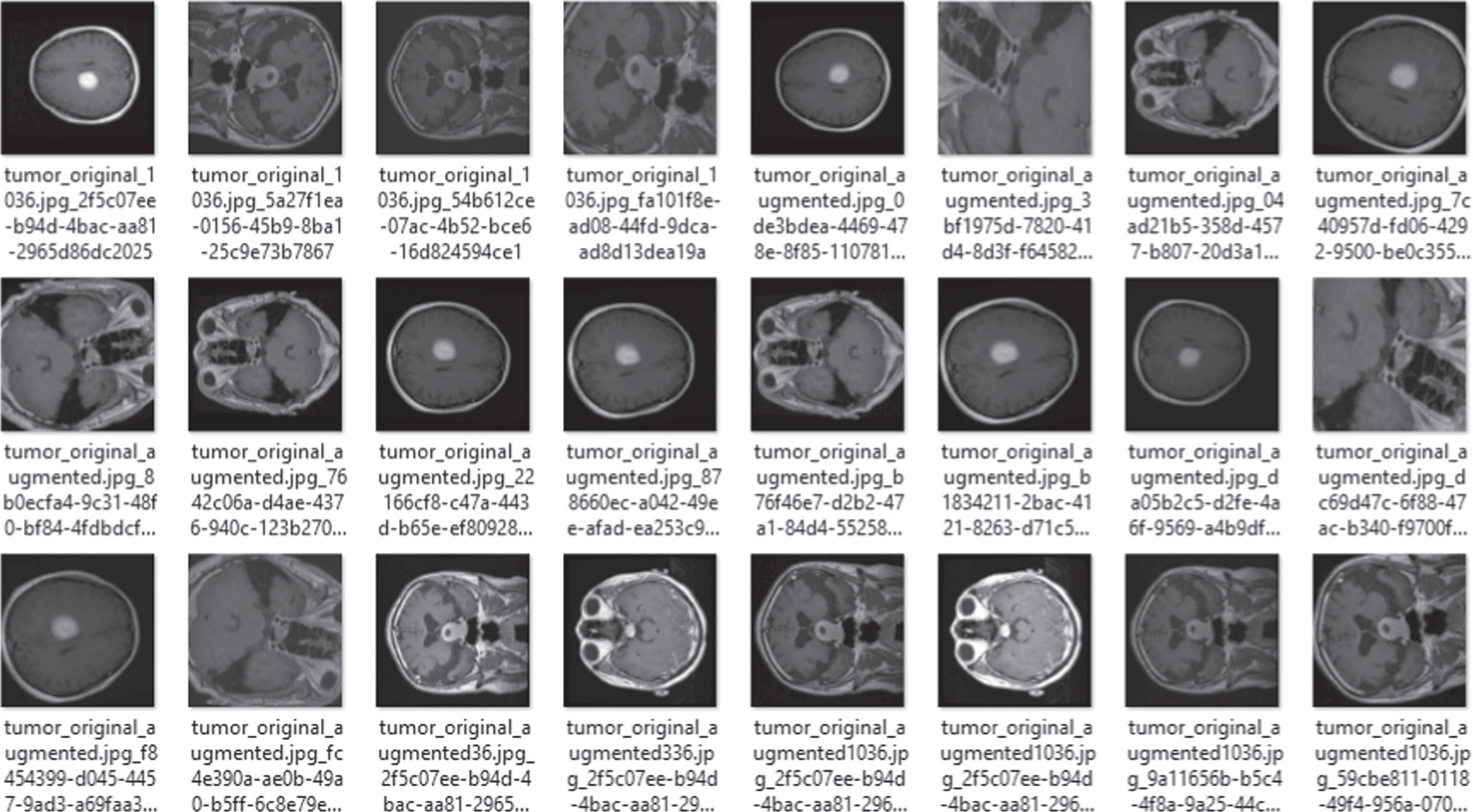 Brain tumor detection through novel feature selection using deep efficientNet-CNN-based features ...