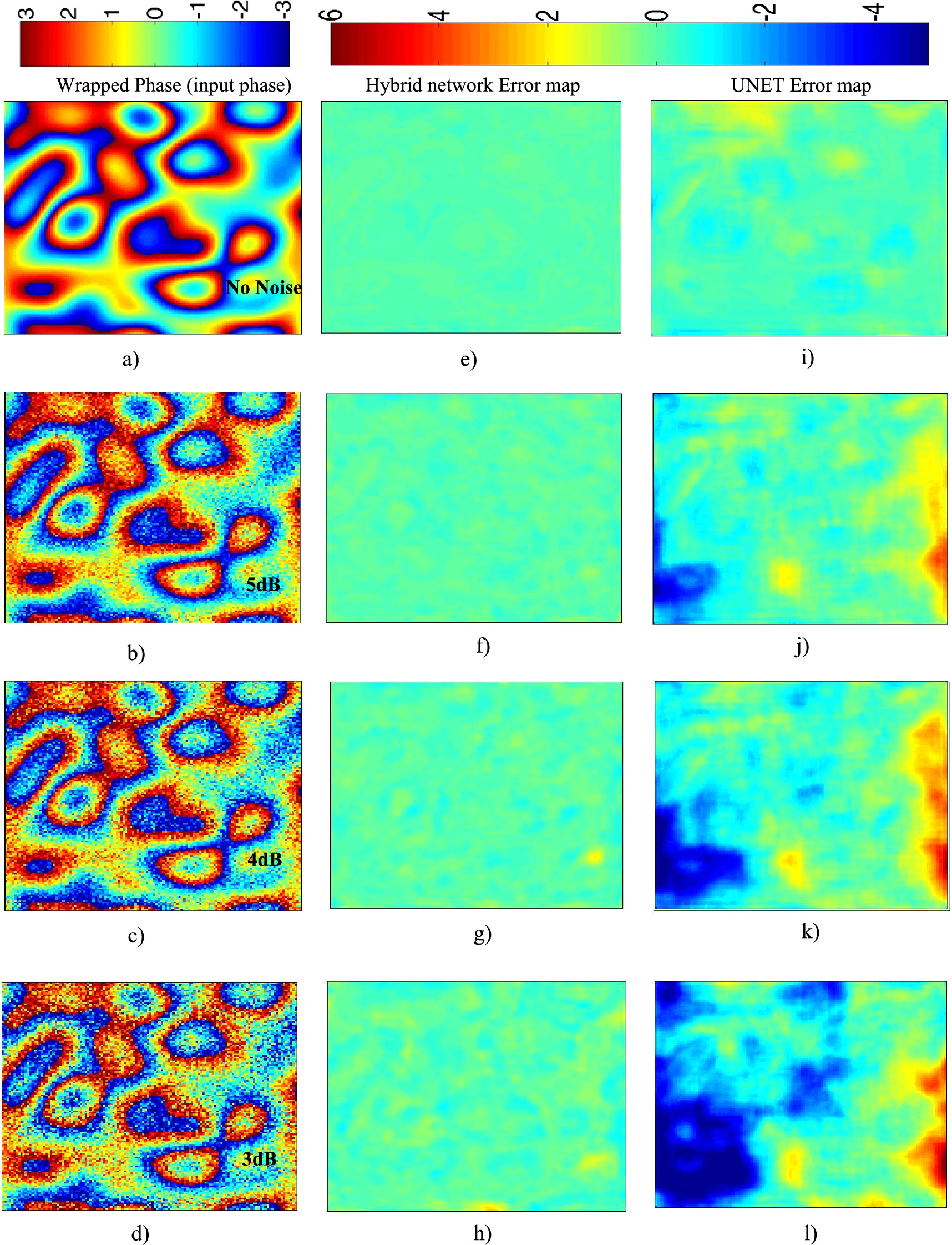 Transformer based deep learning hybrid architecture for phase unwrapping - IOPscience