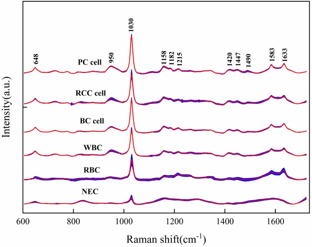 Label-free rapid detection of urinary tumor cells based on surface ...