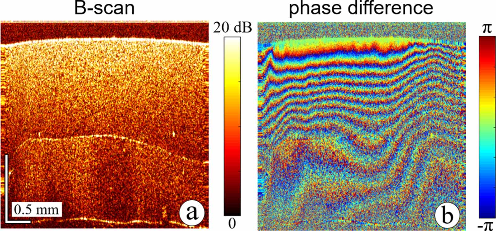 Computationally efficient adaptive optimization of vector-method parameters for phase-sensitive ...