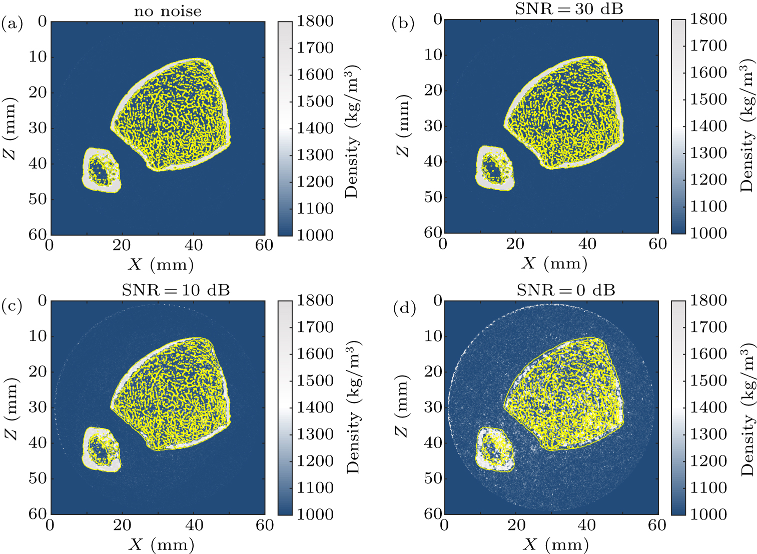 High-resolution bone microstructure imaging based on ultrasonic ...