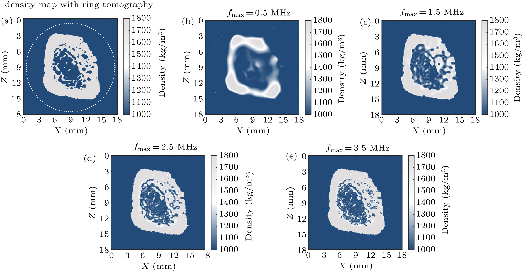 High-resolution bone microstructure imaging based on ultrasonic ...