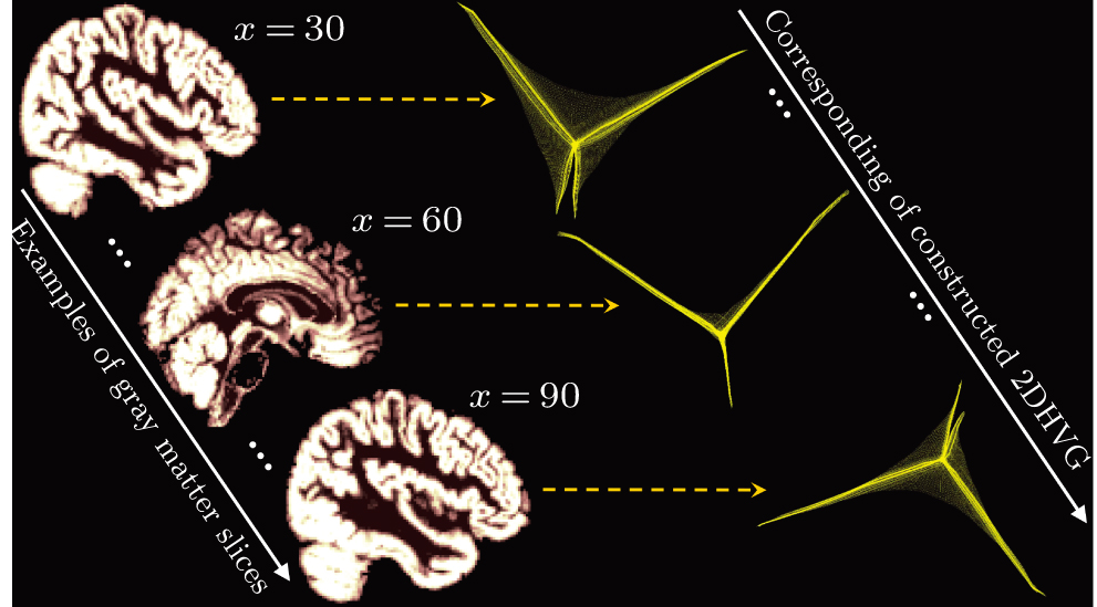 Two-dimensional horizontal visibility graph analysis of human brain ...