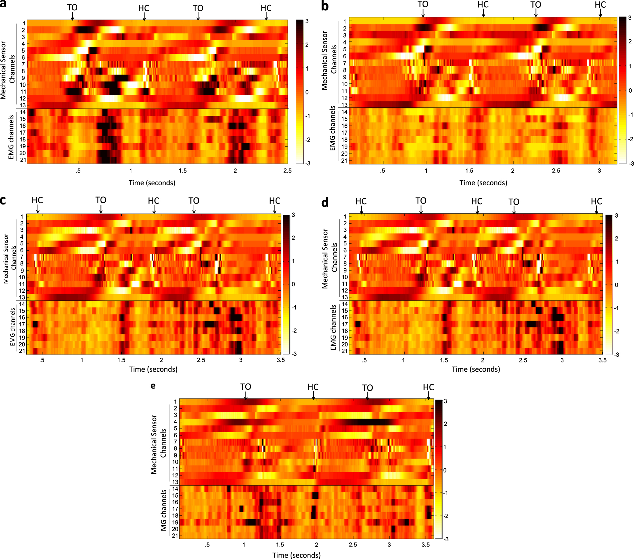 Analysis of using EMG and mechanical sensors to enhance intent recognition in powered lower limb ...