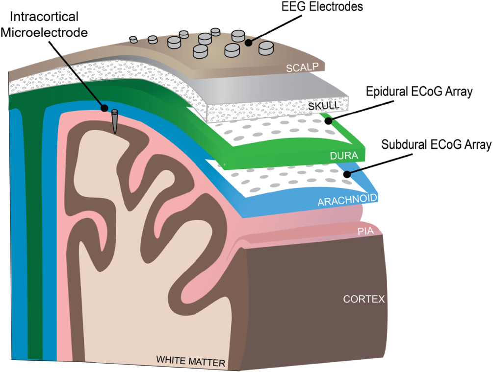 Progress towards biocompatible intracortical microelectrodes for neural ...