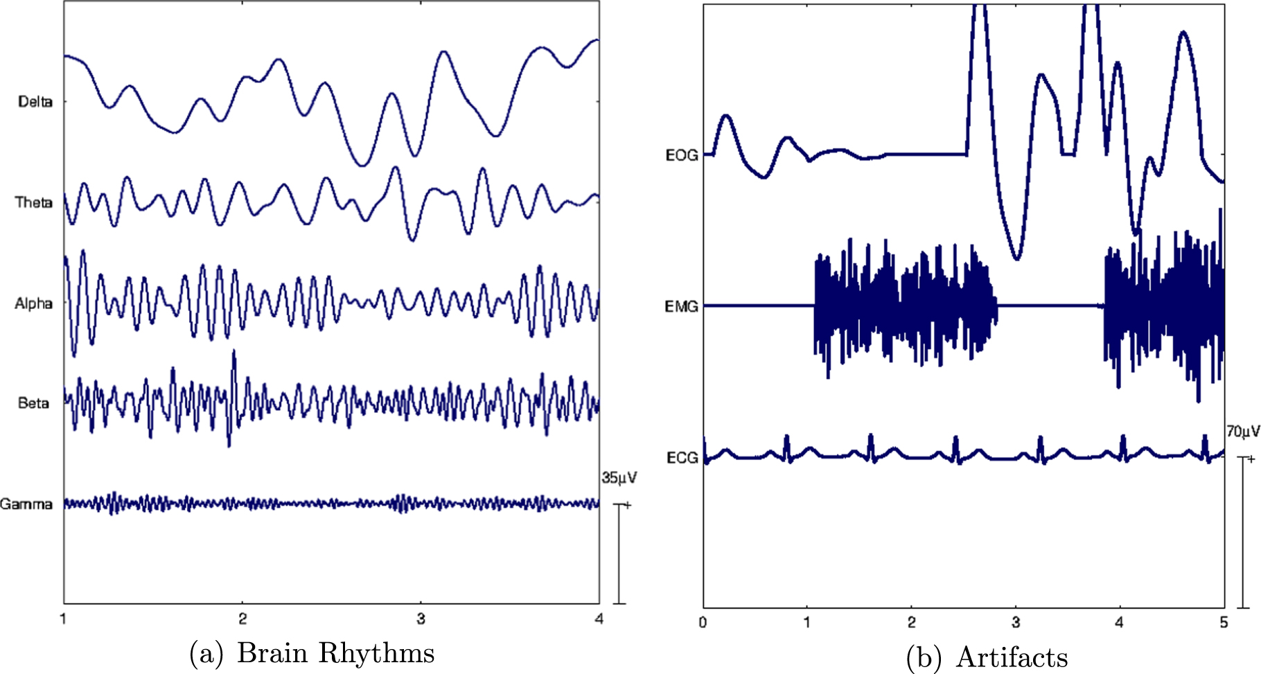 EEG artifact removal—state-of-the-art and guidelines - IOPscience