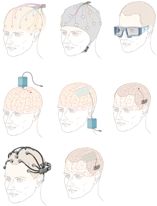 Assessment of brain–machine interfaces from the perspective of people ...