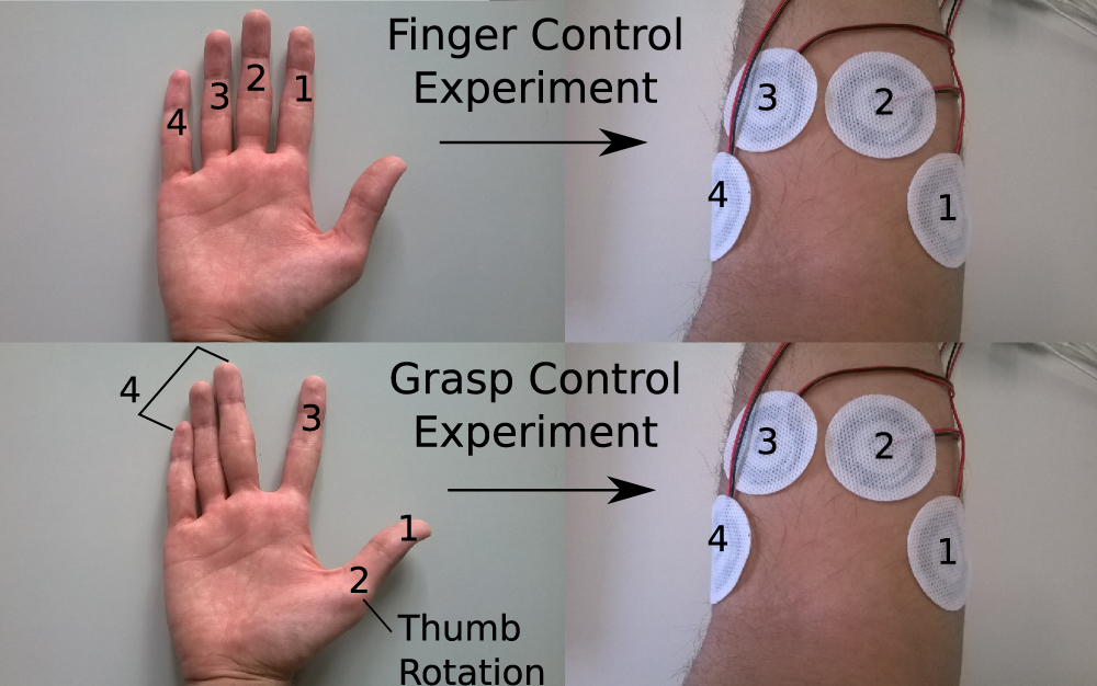 Multichannel electrotactile feedback for simultaneous and proportional ...