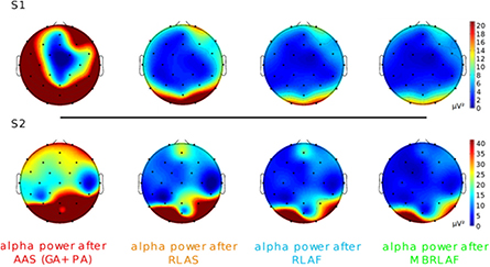 Reference layer adaptive filtering (RLAF) for EEG artifact reduction in simultaneous EEG-fMRI ...