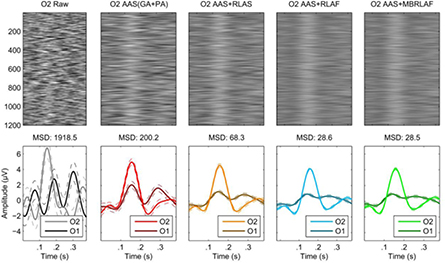 Reference layer adaptive filtering (RLAF) for EEG artifact reduction in simultaneous EEG-fMRI ...