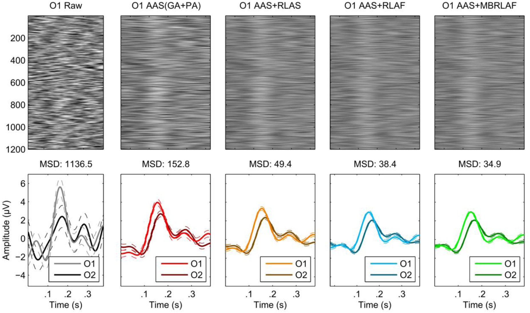 Reference layer adaptive filtering (RLAF) for EEG artifact reduction in simultaneous EEG-fMRI ...