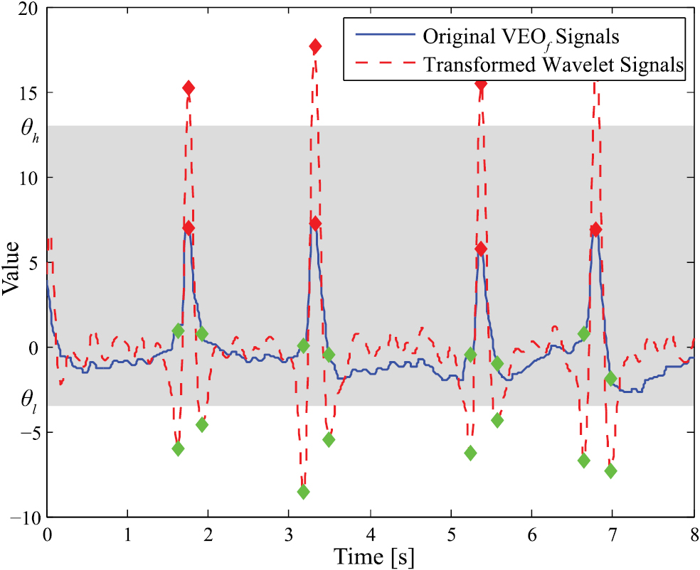 A multimodal approach to estimating vigilance using EEG and forehead EOG - IOPscience
