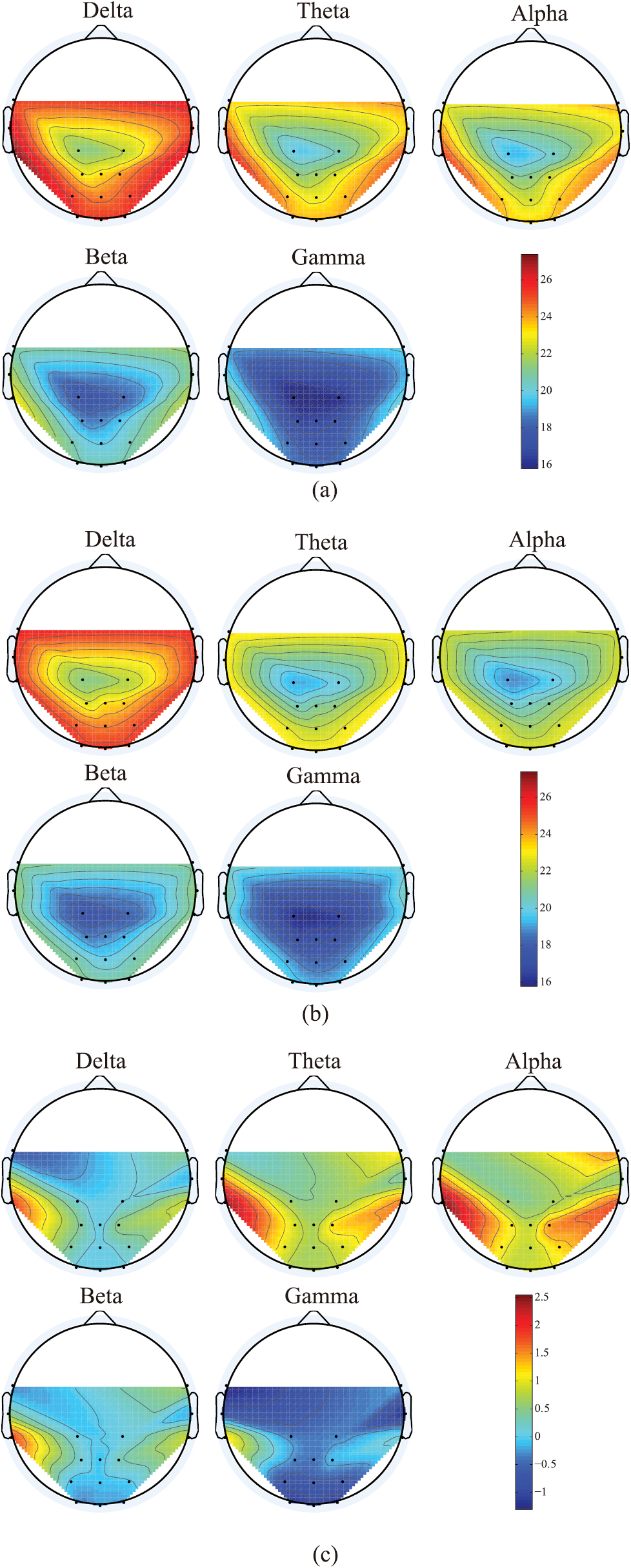 A multimodal approach to estimating vigilance using EEG and forehead EOG - IOPscience