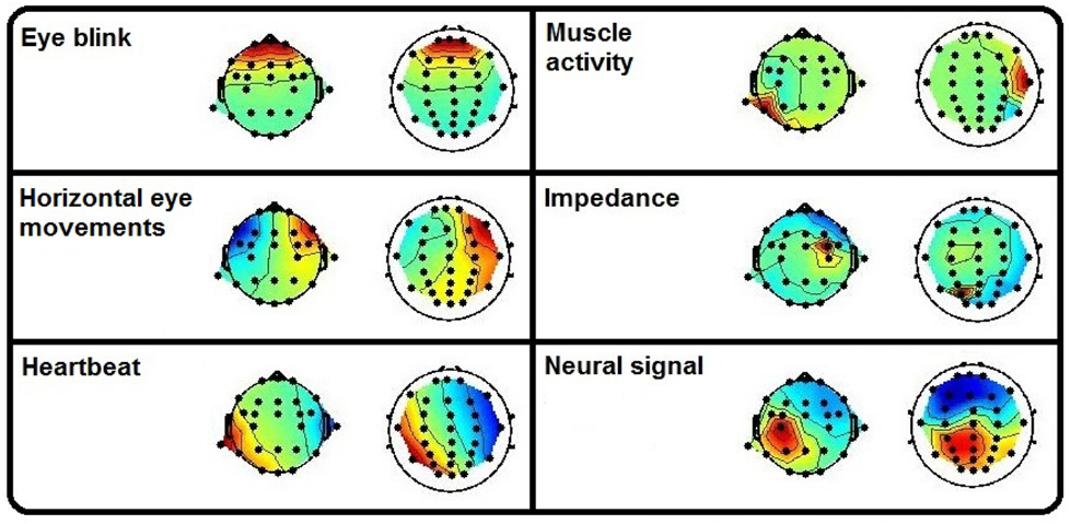 Automated EEG artifact elimination by applying machine learning algorithms to ICA-based features ...