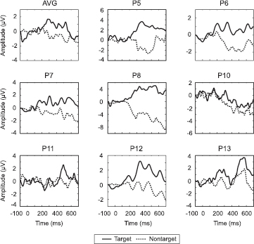 Enhancing clinical communication assessments using an audiovisual BCI ...
