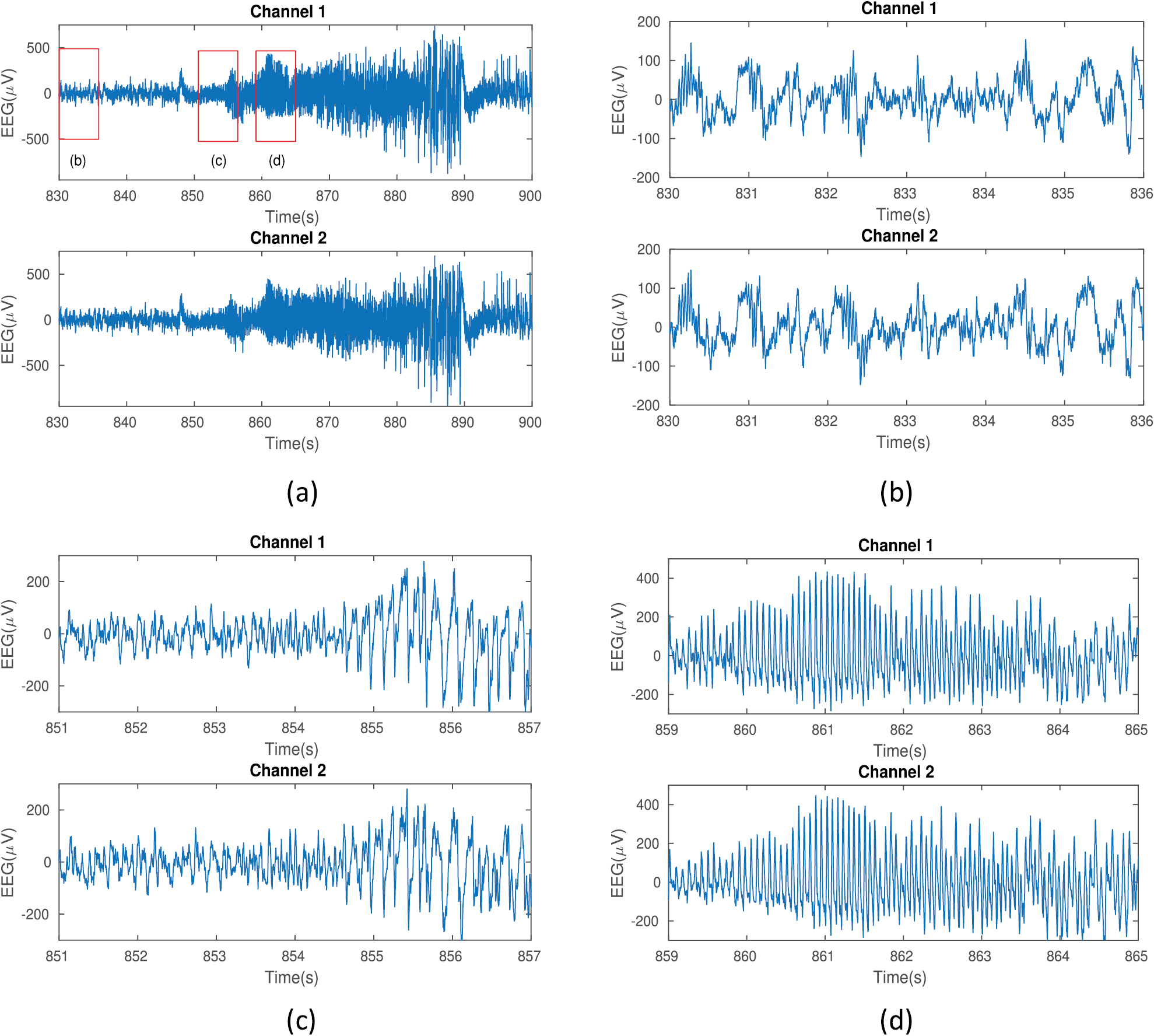 Mouse epileptic seizure detection with multiple EEG features and simple ...