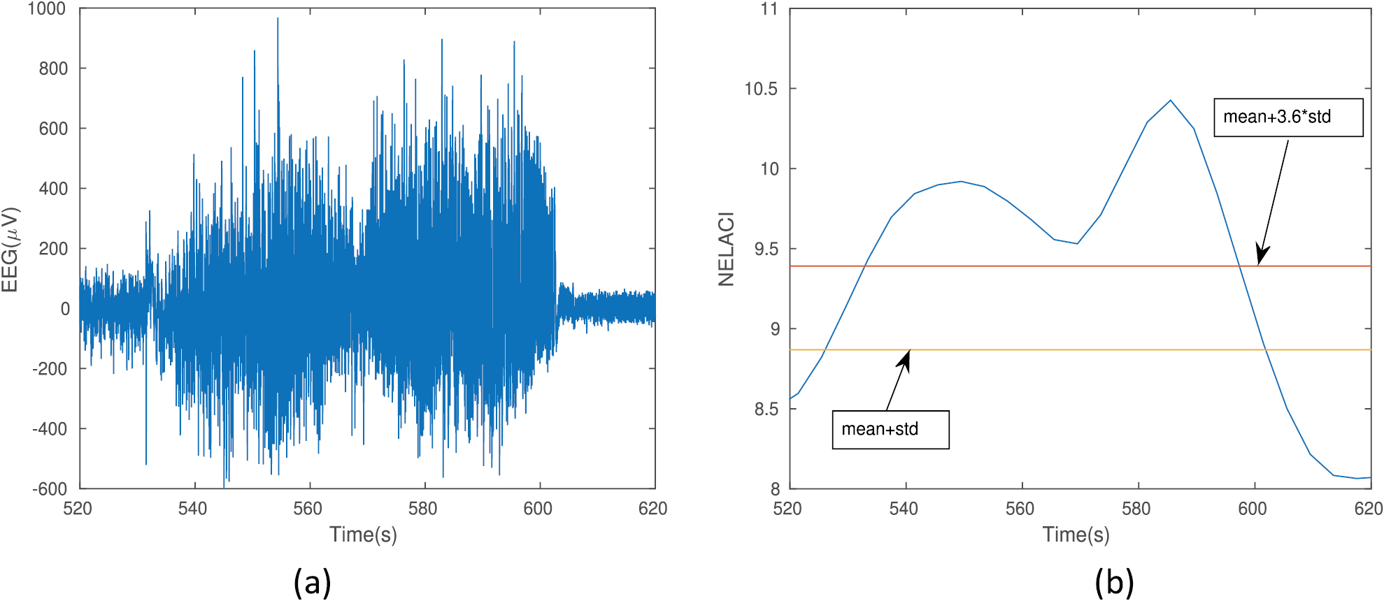 Mouse epileptic seizure detection with multiple EEG features and simple ...