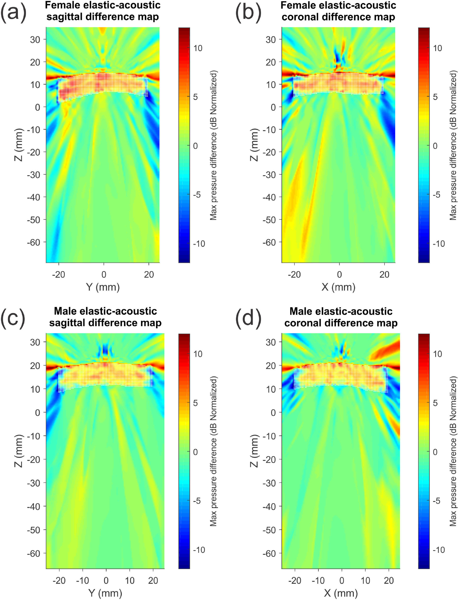 Numerical evaluation of the skull for human neuromodulation with ...