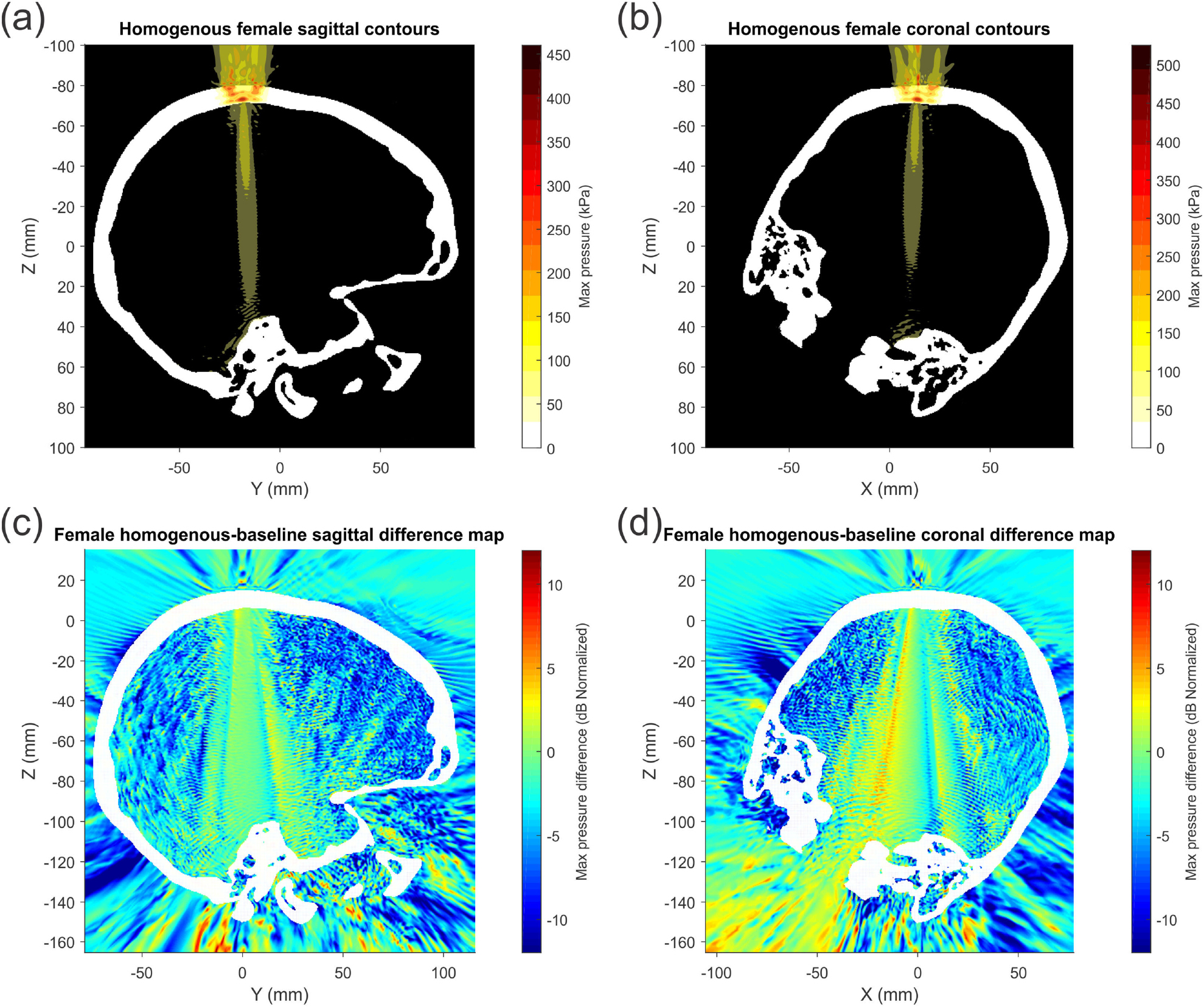 Numerical evaluation of the skull for human neuromodulation with ...