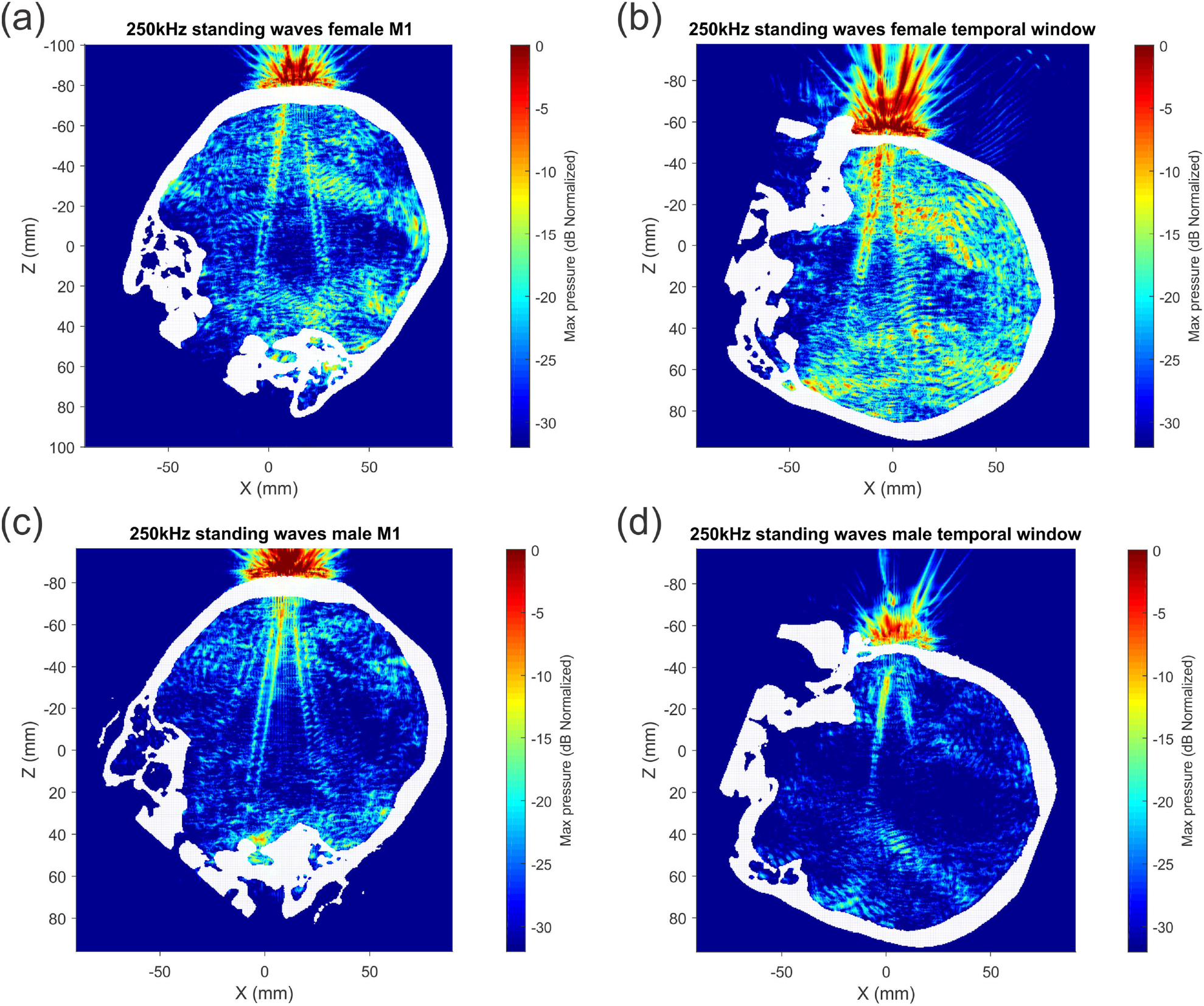 Numerical evaluation of the skull for human neuromodulation with ...