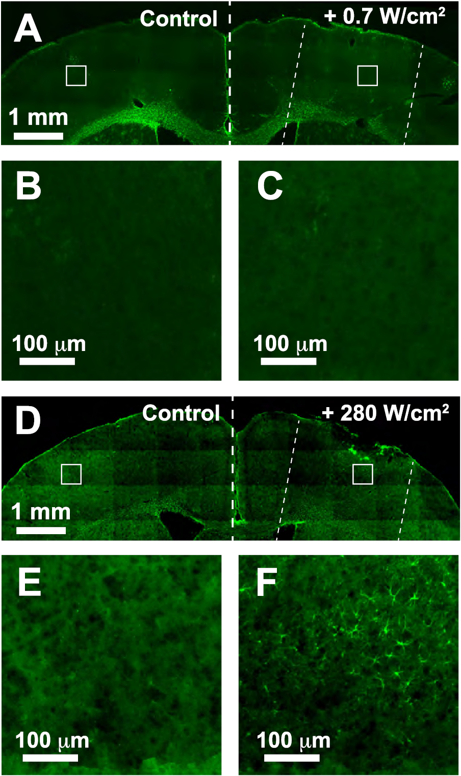 Low-intensity focused ultrasound alters the latency and spatial ...