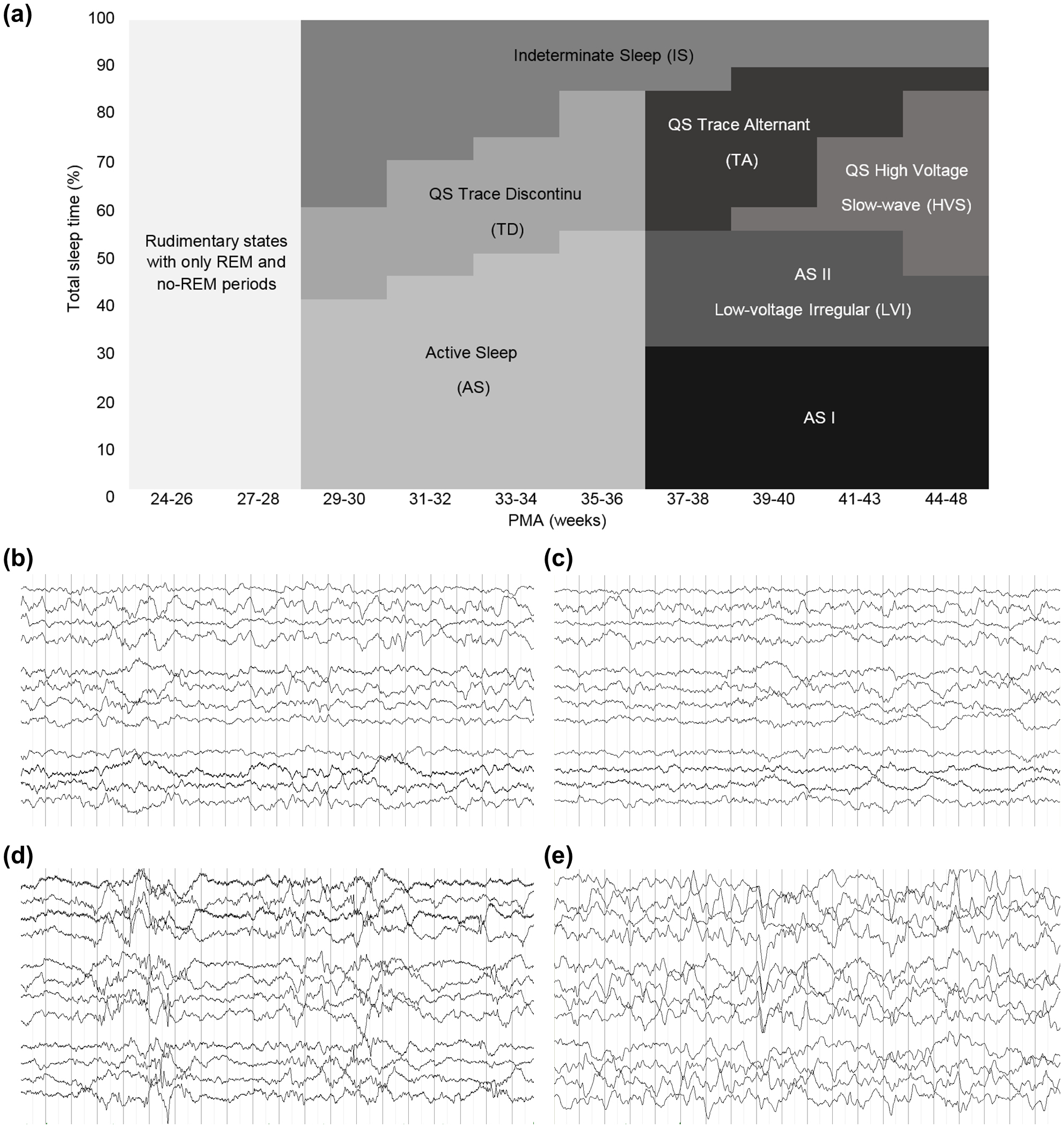 Automated EEG sleep staging in the term-age baby using a generative ...