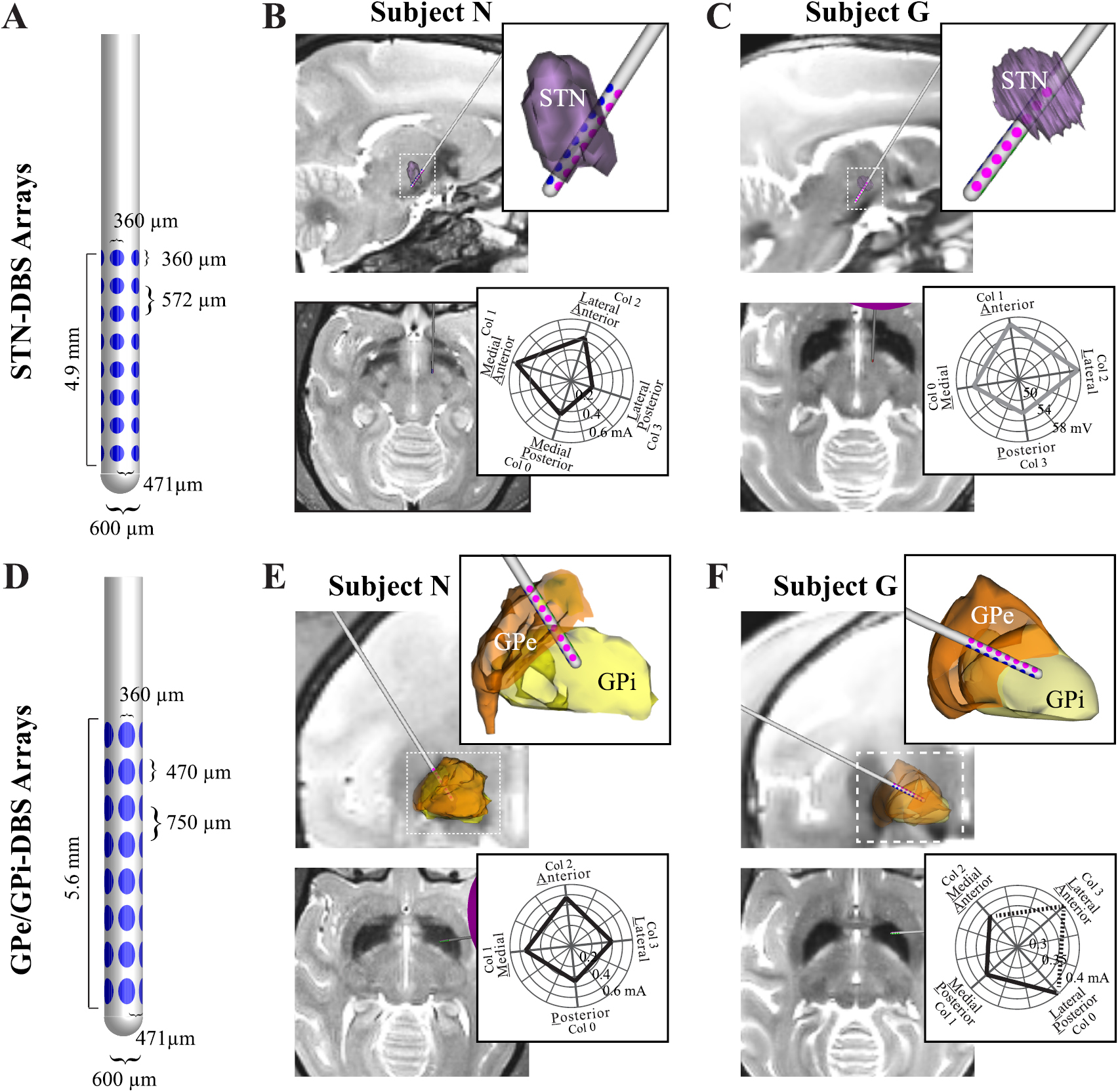 High-resolution local field potentials measured with deep brain ...