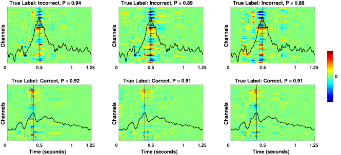 Eegnet A Compact Convolutional Neural Network For Eeg Based Braincomputer Interfaces Iopscience