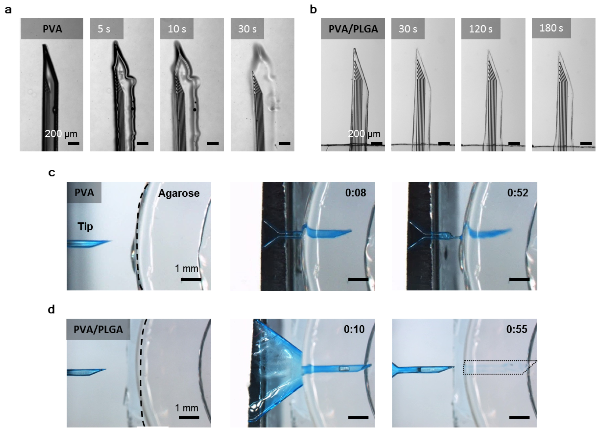 A bilayered PVA/PLGA-bioresorbable shuttle to improve the implantation ...