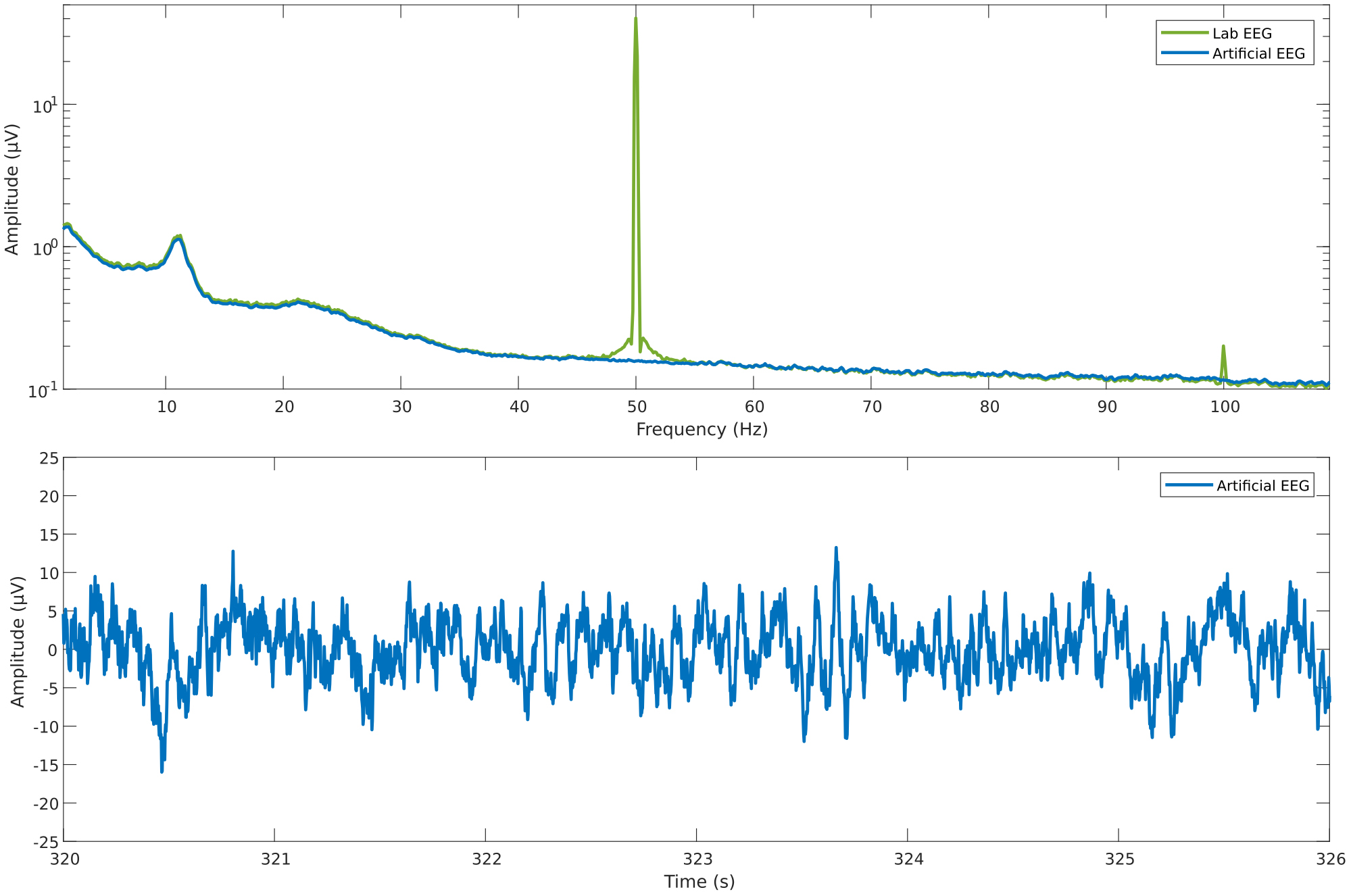 Artifacts in EEG of simultaneous EEG-fMRI: pulse artifact remainders in ...